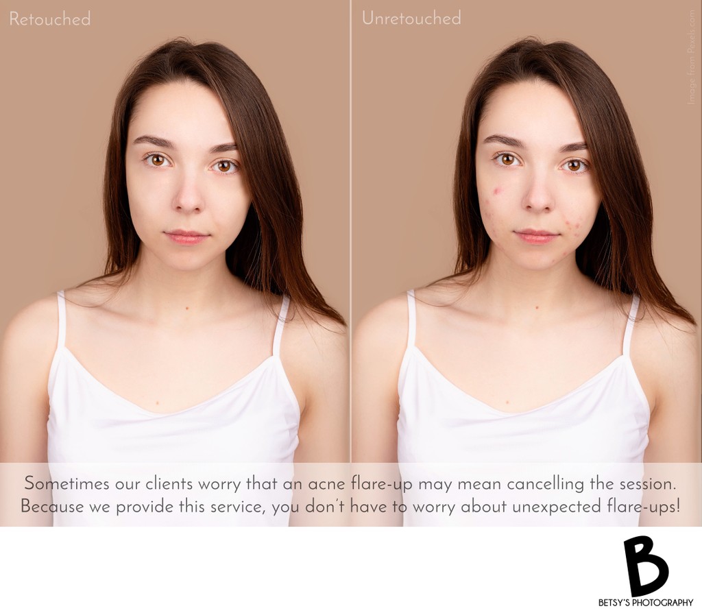 Acne, Blemishes, and Braces - Betsy's Photography